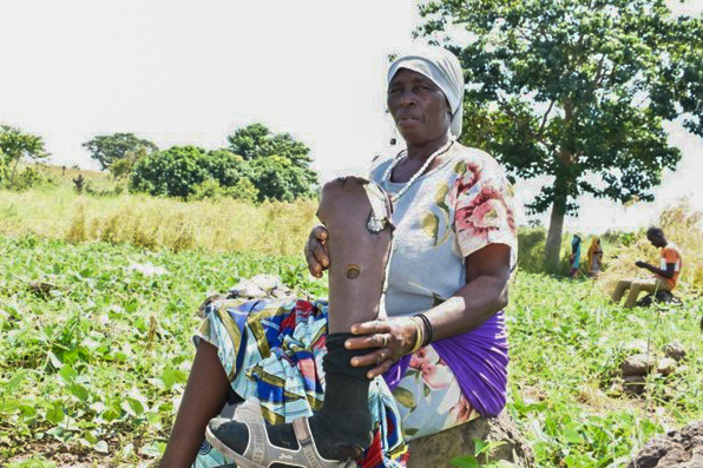 Rakiya's journey towards economic empowerment despite adversity | Mercy ...